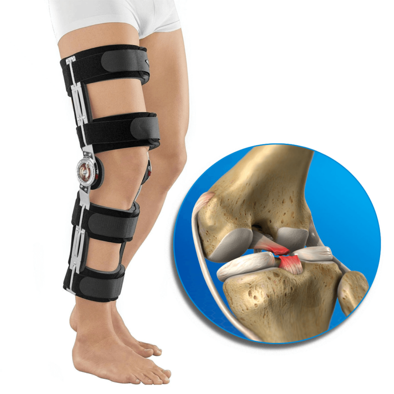 ÖN ÇAPRAZ BAĞ TEDAVİSİ - Borfiz Fizik Tedavi ve Rehabilitasyon Tıp Merkezi